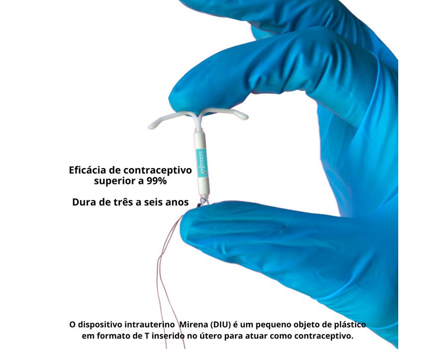 Mirena 52mg, caixa com 1 SIU + 1 insertor | Sampharma Medicamentos ...